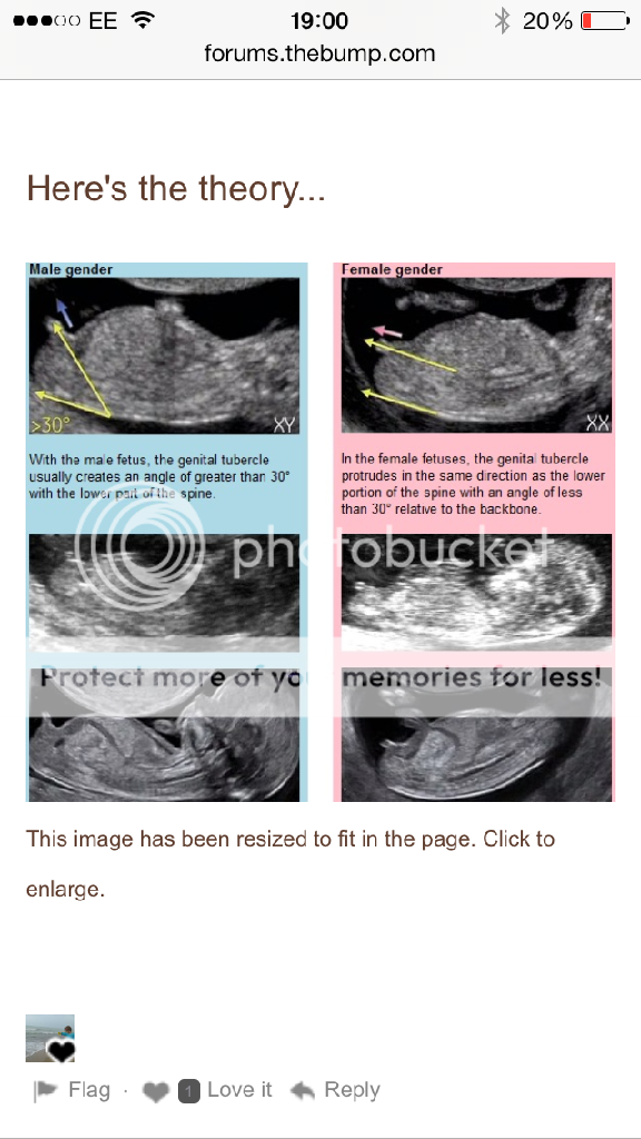 Nub theory explained with pictures :) hope this helps!! X | BabyCentre